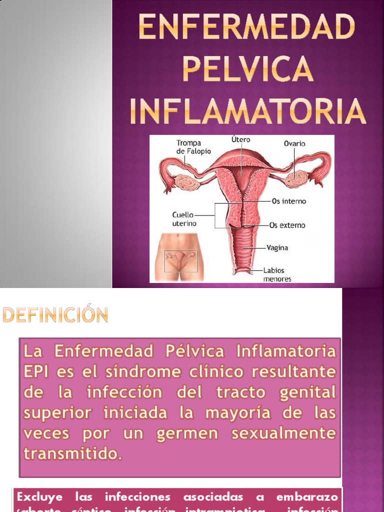 Enfermedad Pelvica Inflamatoria | PDF | Microbiología | Rtt