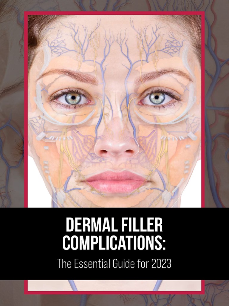 Dermal Filler Complications Essential Guide 2023 PDF | PDF | Blood ...
