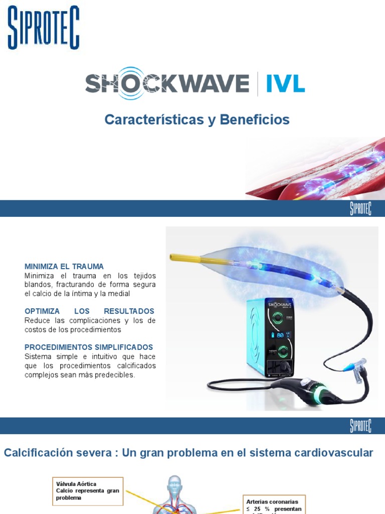 Shockwave Ivl, Caracteristica y Beneficios PDF | PDF | Angiología | Sistema cardiovascular