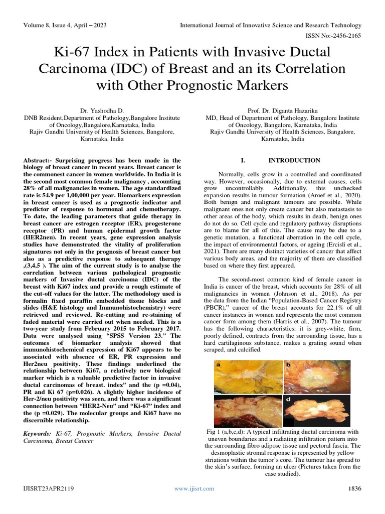 Ki-67 Index in Patients With Invasive Ductal Carcinoma (IDC) of Breast and An Its Correlation ...