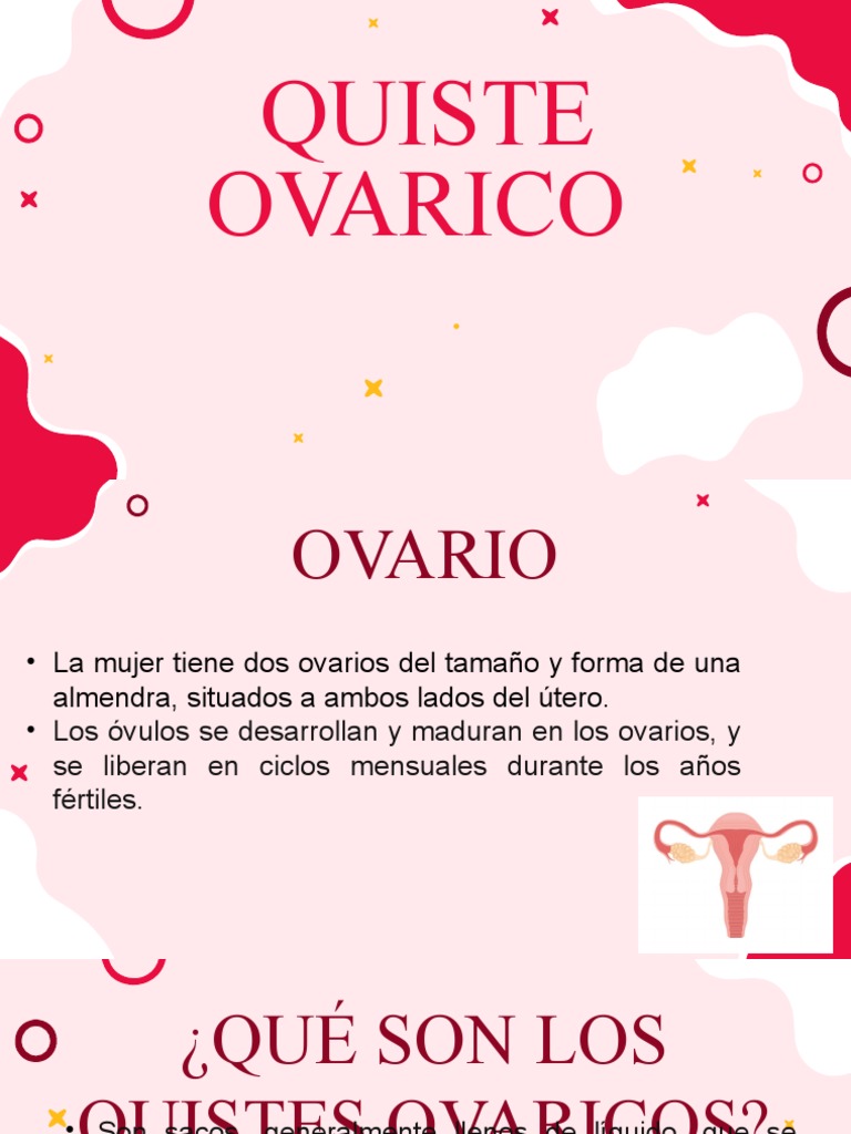 QUISTE | PDF | Ovario | Sistema Reproductor Mamífero