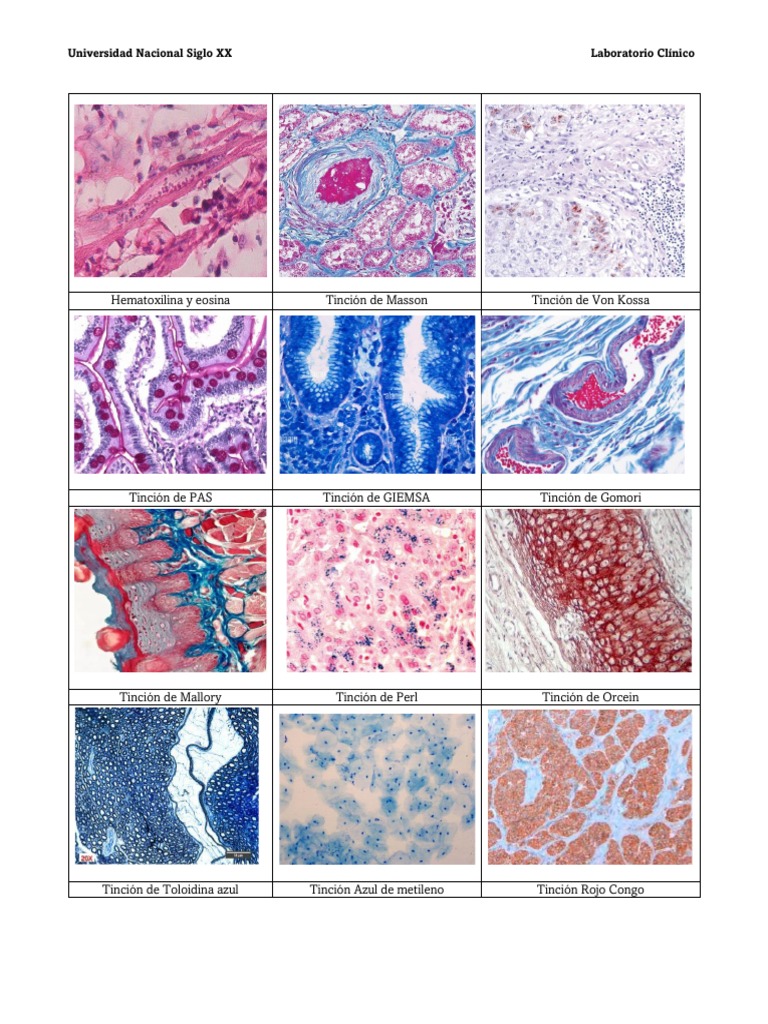 TINCIONES HISTOLOGÍA. Histo | PDF