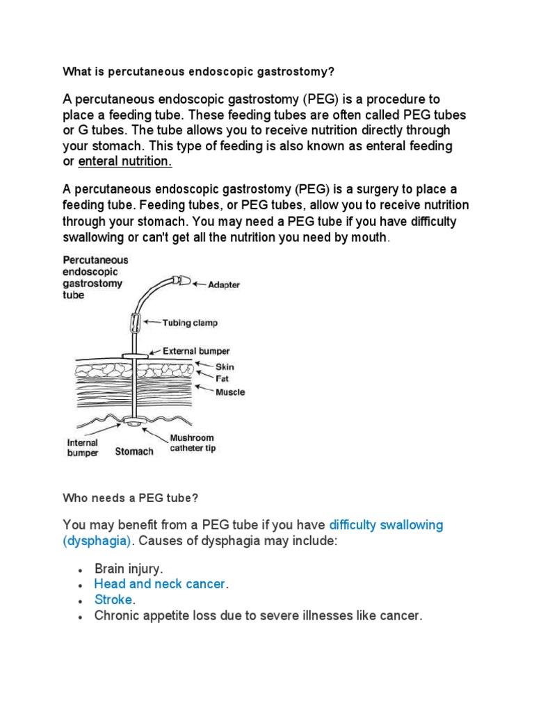What Is Percutaneous Endoscopic Gastrostomy | PDF | Clinical Medicine ...