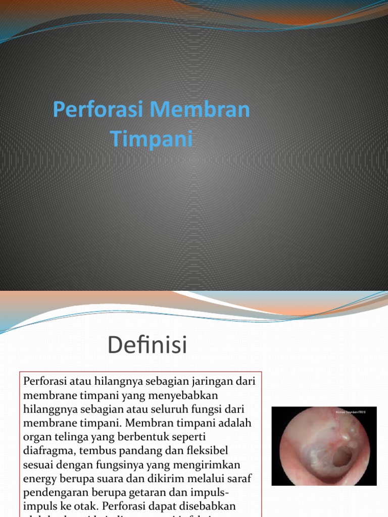 Perforasi - Membran - Timpani Alken | PDF
