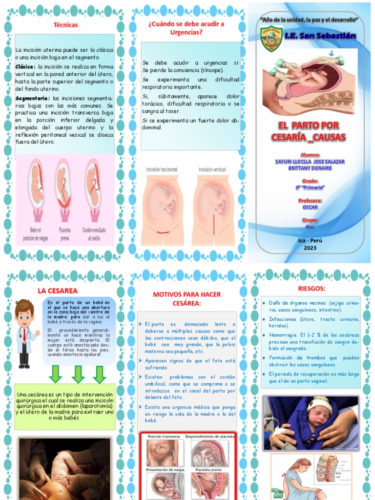 Triptico Parto Por Cesarea - Causass | Descargar gratis PDF | Parto | Seccion de cesárea
