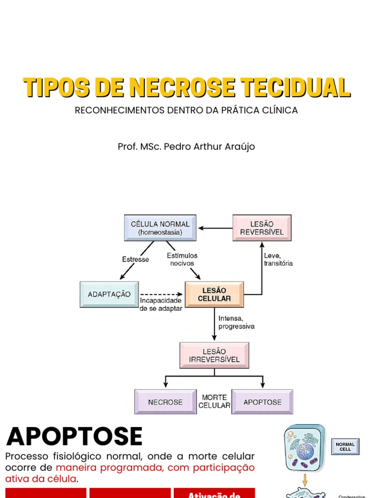 TIPOS DE NECROSE E MECANISMOS DE RECONHECIMENTO | PDF | Necrose | Apoptose