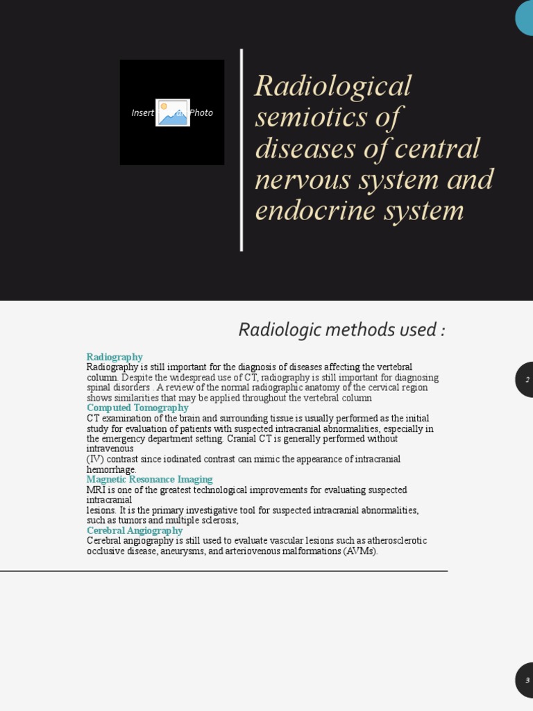 Radiological Semiotics of Diseases of Central Nervous System | PDF ...