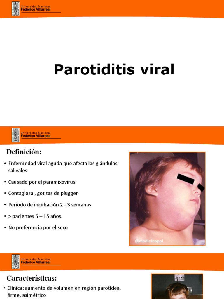 reporte de caso clinico parotiditis viral (vasquez osis)-1-5 | PDF