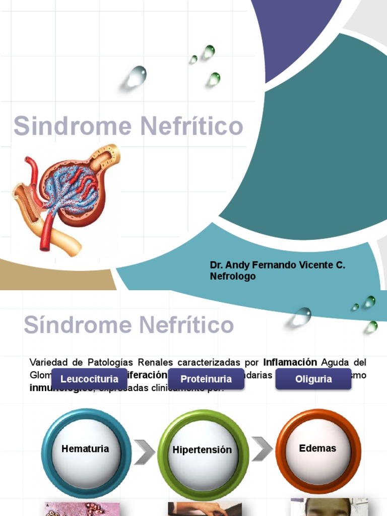 SINDROME NEFRITICO.pptx | PDF | Órgano (anatomía) | Especialidades Medicas