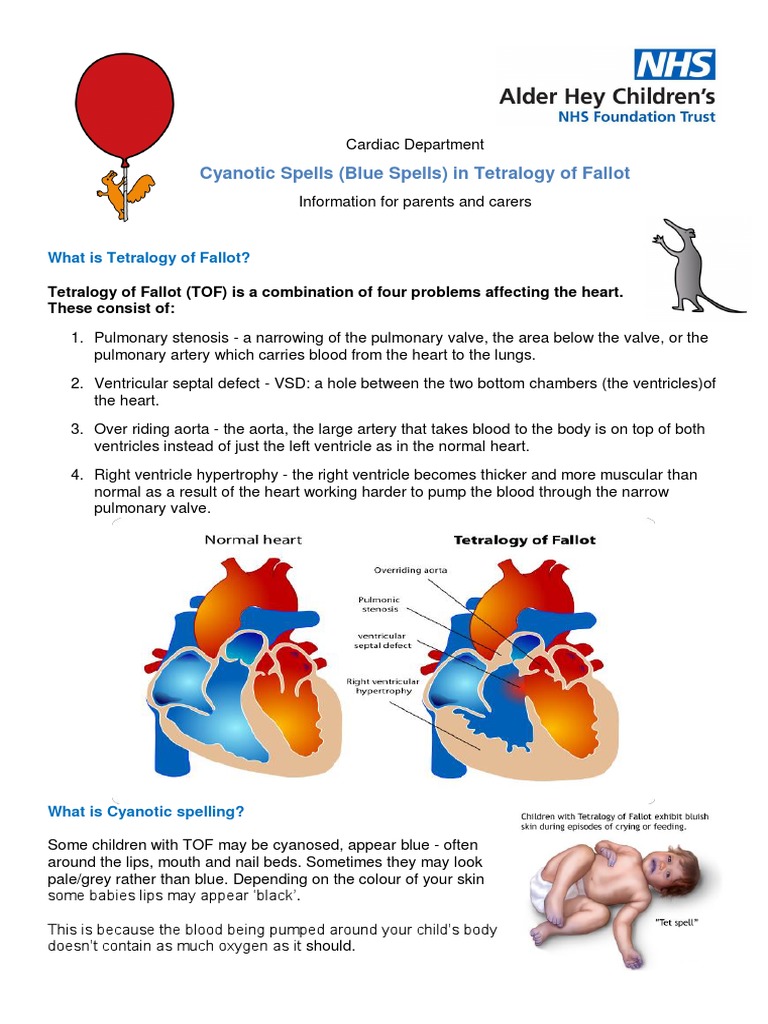 Cyanotic Spells Blue Spells in Tetralogy of Fallot - PIAG 214 | PDF ...