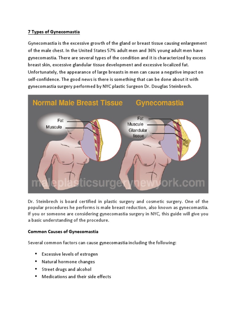 7 Types of Gynecomastia | PDF | Surgery | Breast