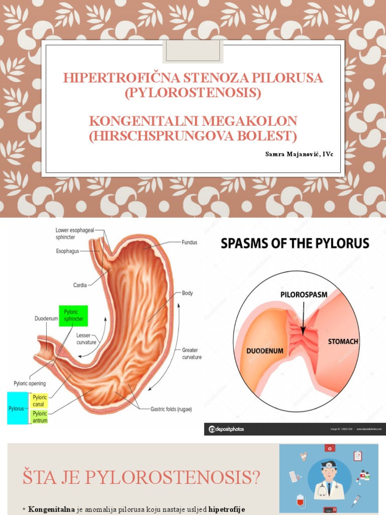 HIPERTROFIČNA STENOZA PILORUSA (Pylorostenosis) | PDF