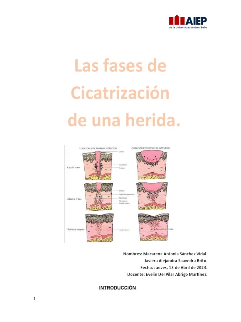 Las etapas clave de la cicatrización de heridas: hemostasia ...