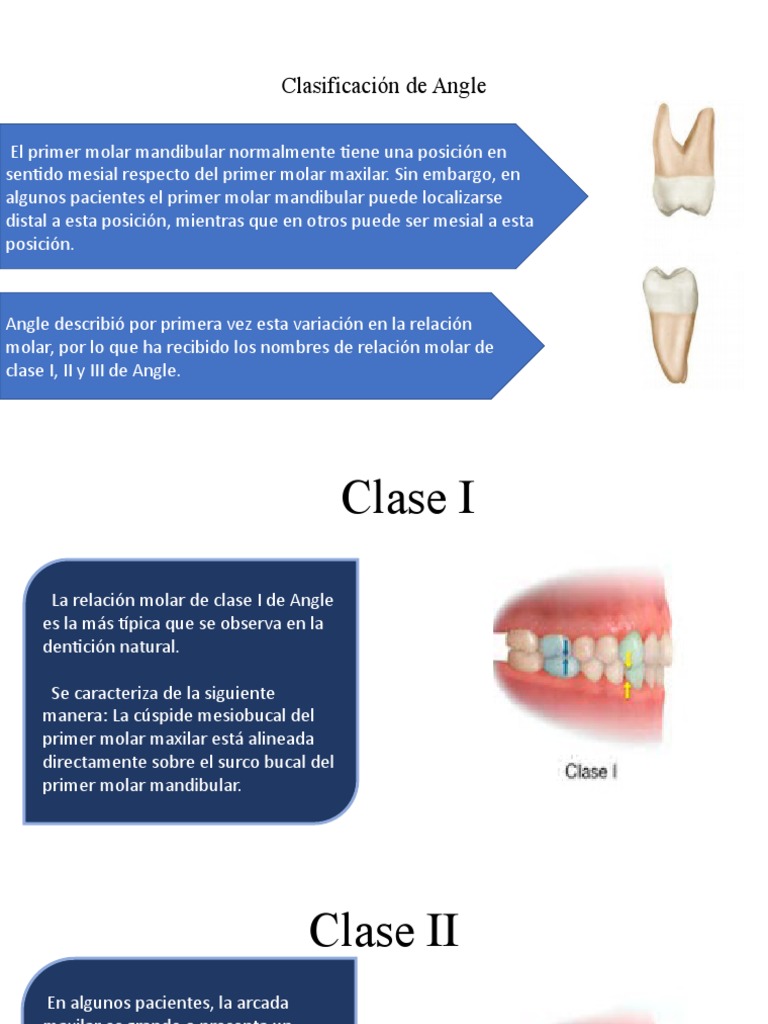 Clasificación Molar de Angle | PDF | Salud y bienestar
