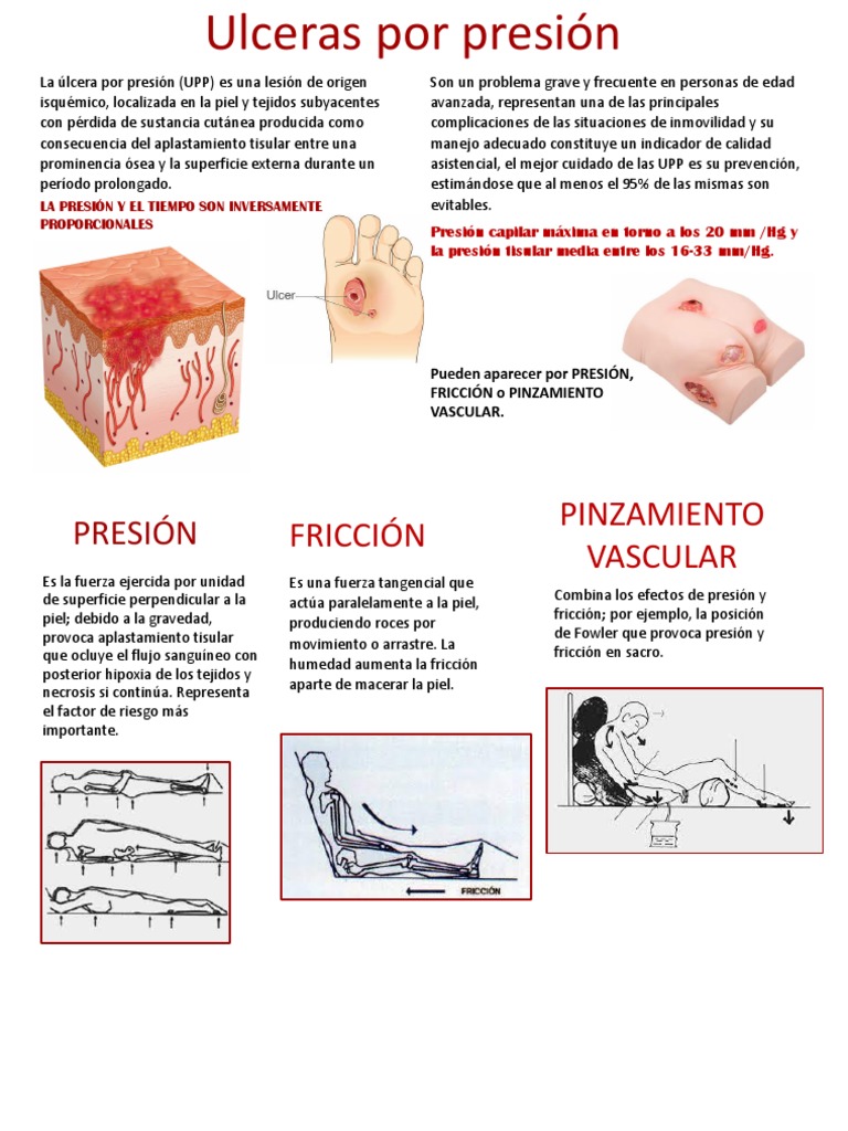Ulceras por presión.pdf | PDF | Herida | Piel
