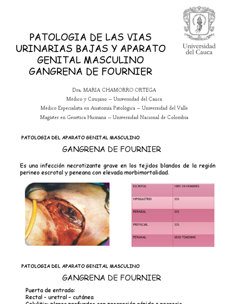 Patologia Del Aparato Genital Masculino Gangrena de Fournier | PDF