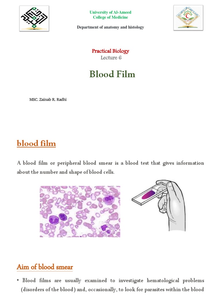 Examination of Blood Films: A Guide to Preparing Quality Slides and ...