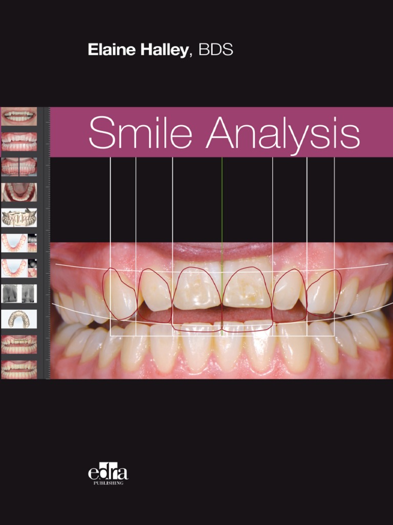Smile Analysis PDF | PDF | Dentistry | Physical Attractiveness