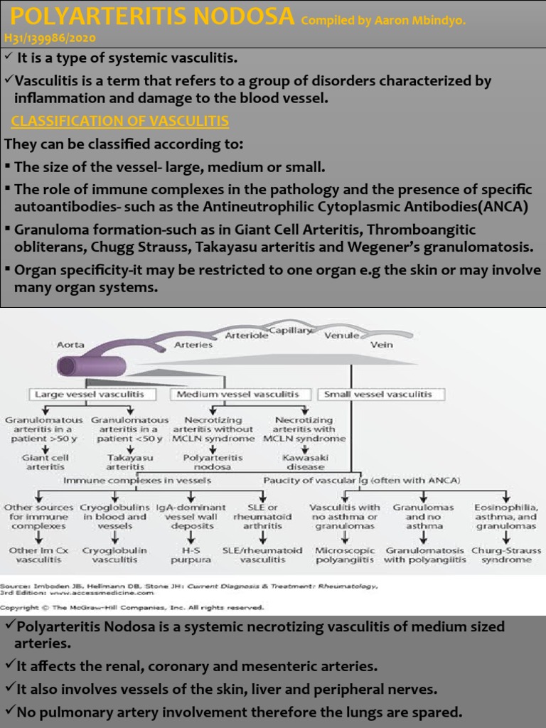 Polyarteritis Nodosa | PDF | Blood Vessel | Medical Specialties