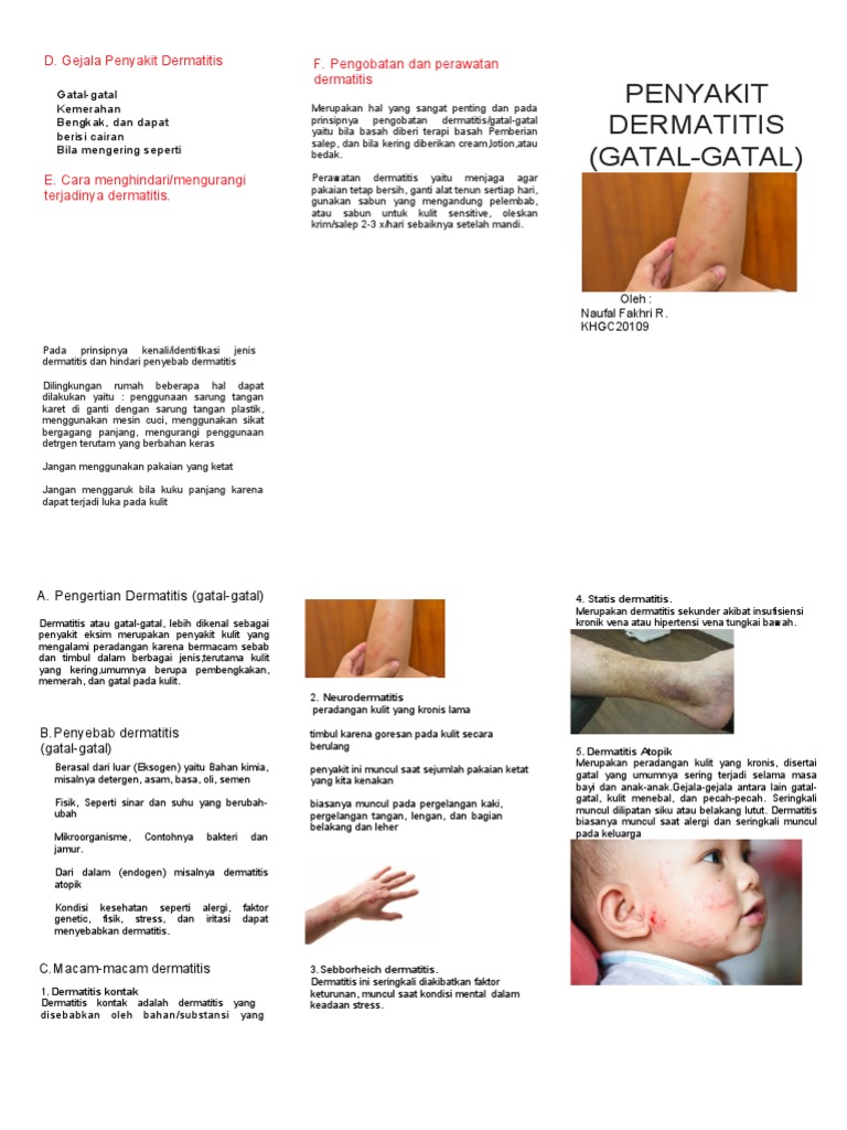 Leaflet Dermatitis Tugas KMB | PDF