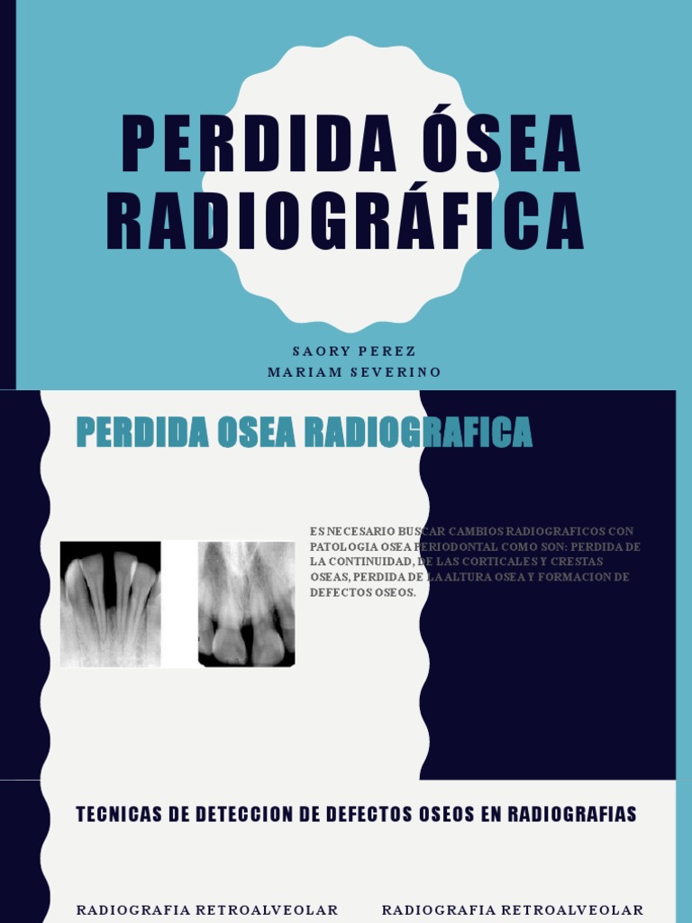 Perdida ósea radiográfica.pptx | PDF