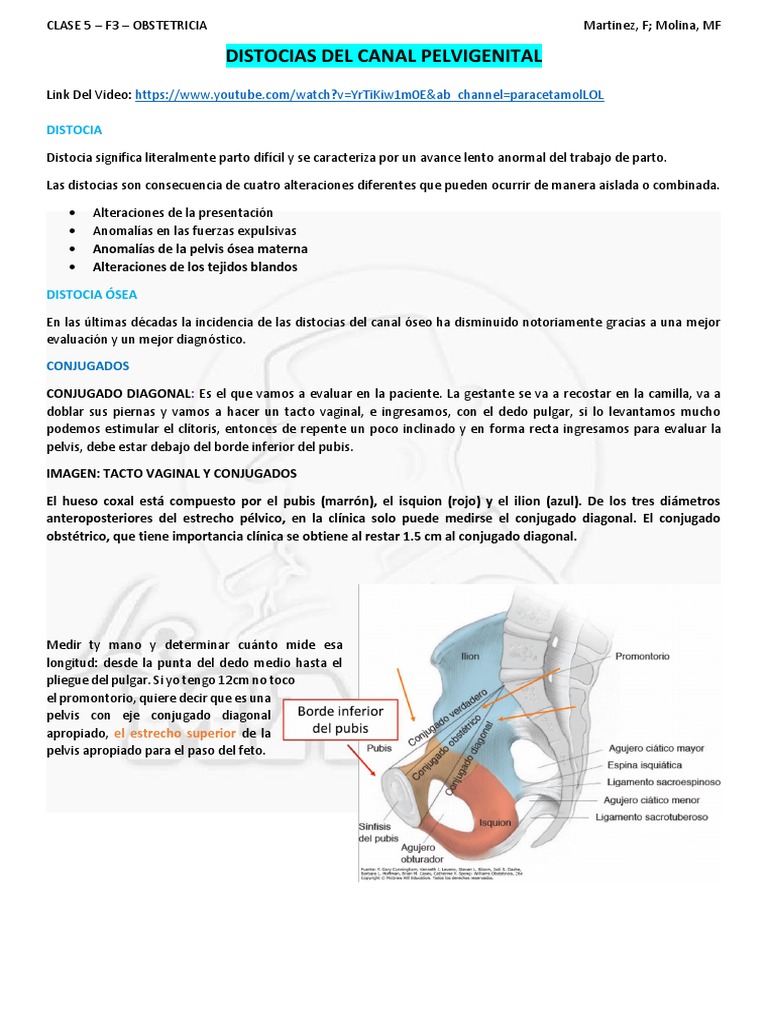 Alumbramiento Patologico + Distocias | PDF | Parto | Pelvis