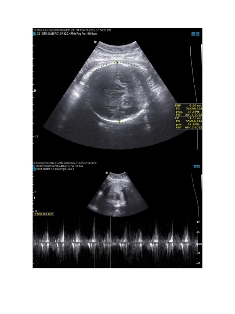 Ultrasonido PDF | PDF