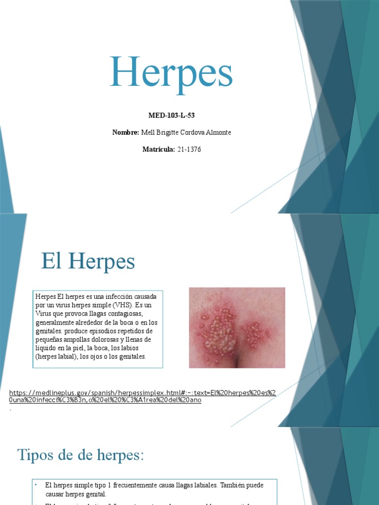 Herpes | PDF