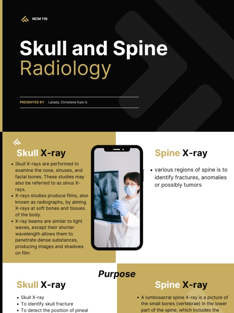 Skull and Spine Imaging Techniques | PDF | Self-Improvement | Wellness