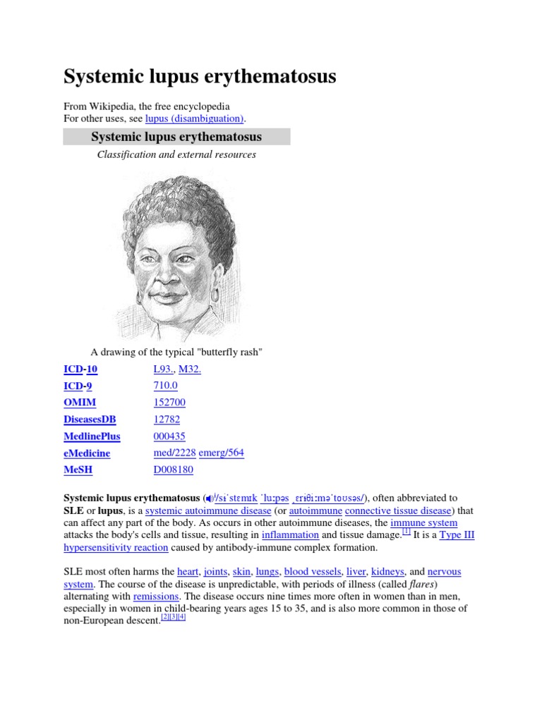 Systemic Lupus Erythematosus | PDF | Systemic Lupus Erythematosus ...