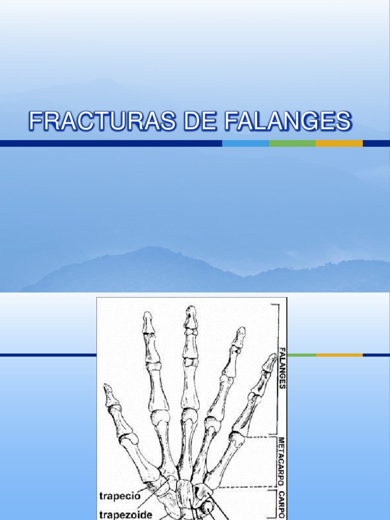 Fracturas de Falanges: Diagnóstico y Tratamiento | PDF | Lesión ...