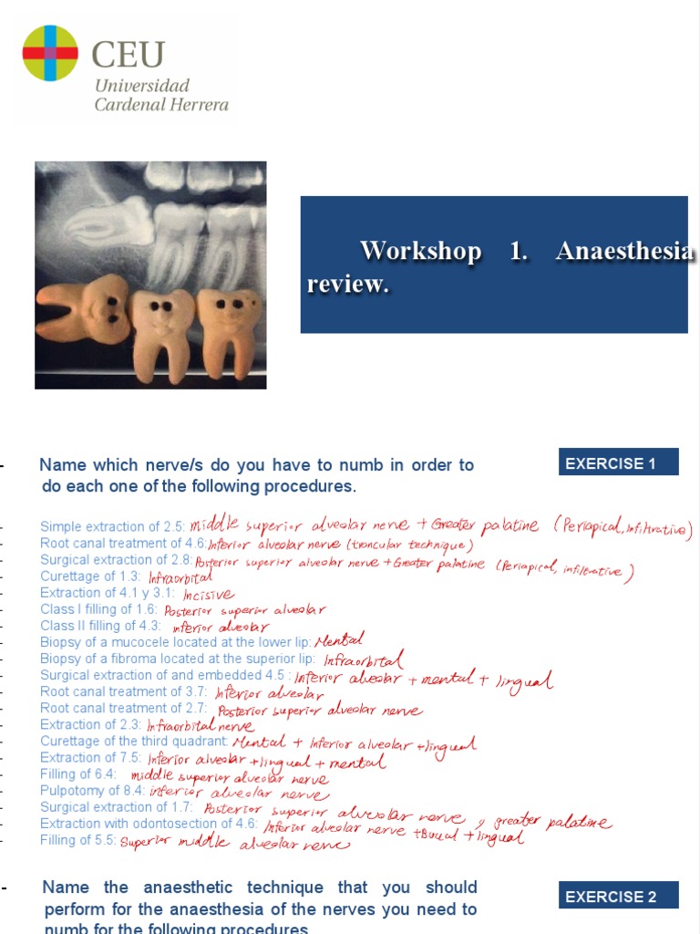Navigating Local Anesthesia: A Comprehensive Guide to Anesthetic ...