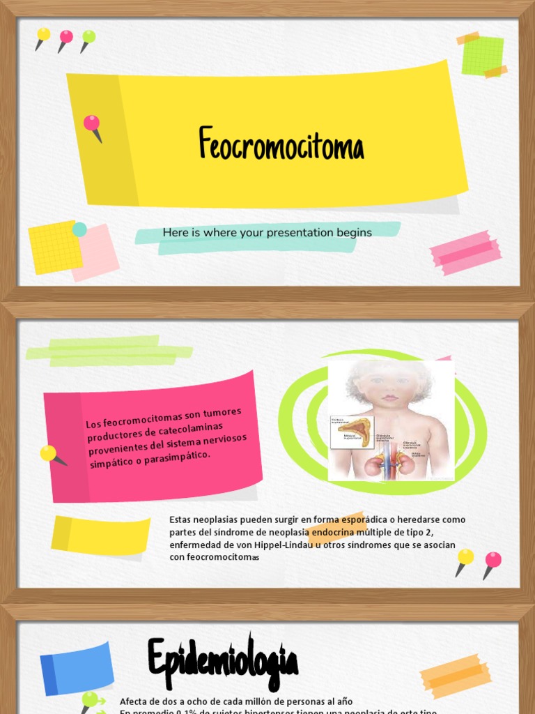 Feocromocitoma y PTH | PDF | Vitamina D | Especialidades Medicas