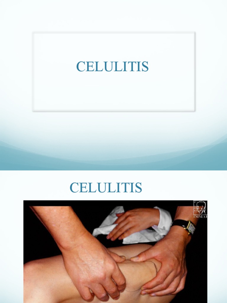 PEFE Celulitis IMMAE | PDF