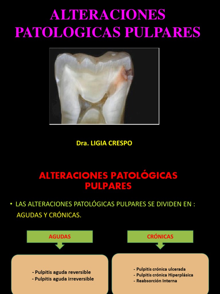 Clasificación de Enfermedades Pulpares PDF | PDF | Dolor | Ciencias de ...