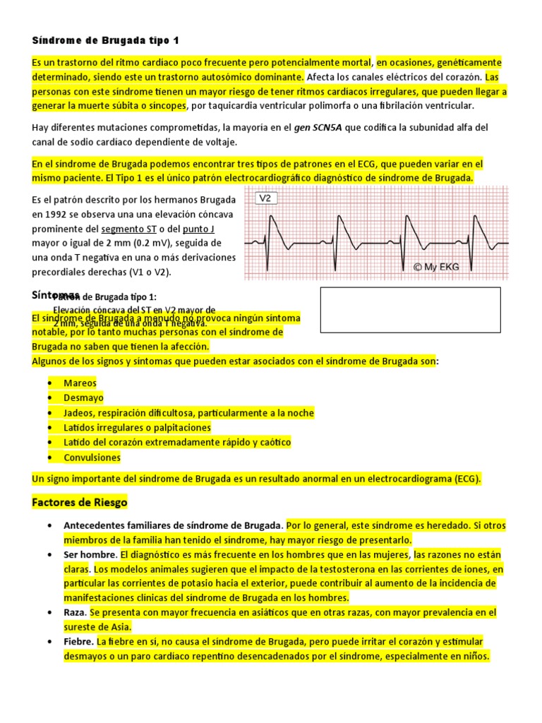 Síndrome de Brugada Tipo 1 | PDF | Electrocardiografia | Medicina Interna