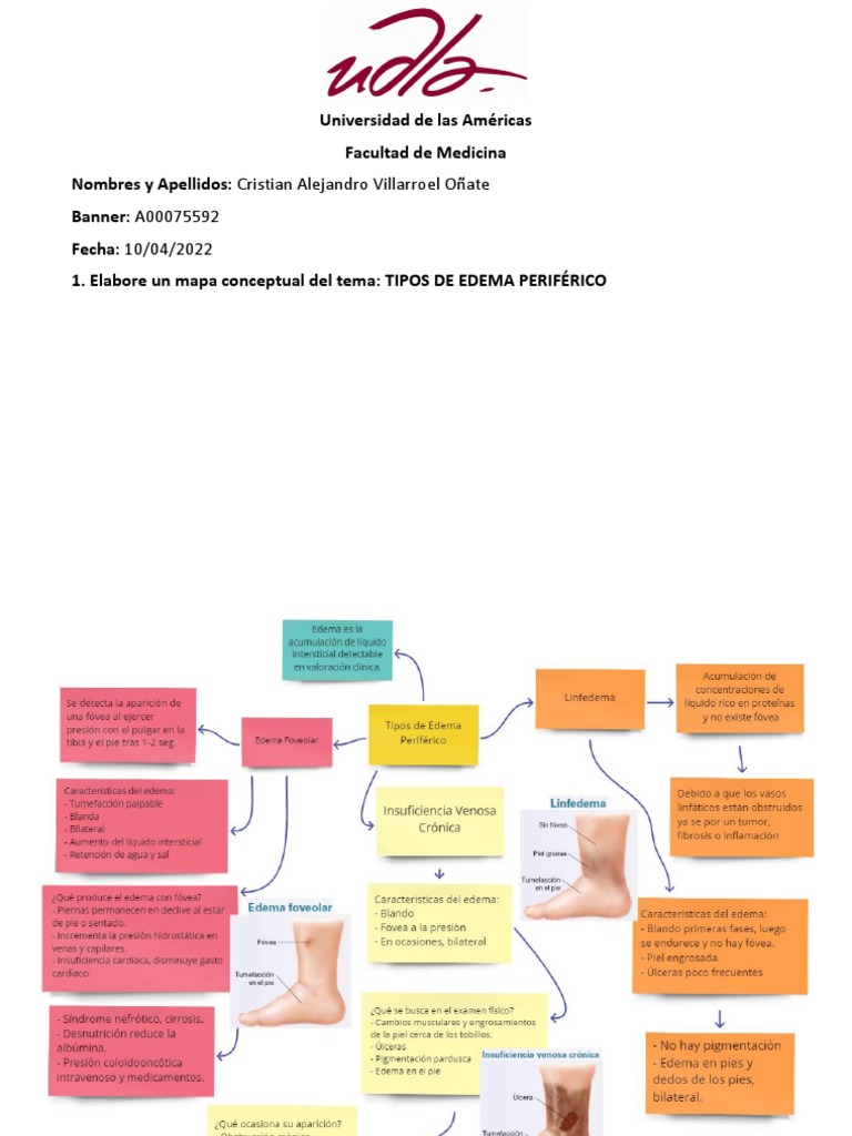 Mapa Conceptual - Tipos de edema periférico | PDF