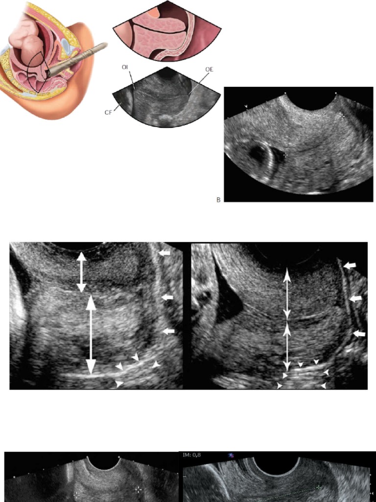 Longitud Cervical | PDF
