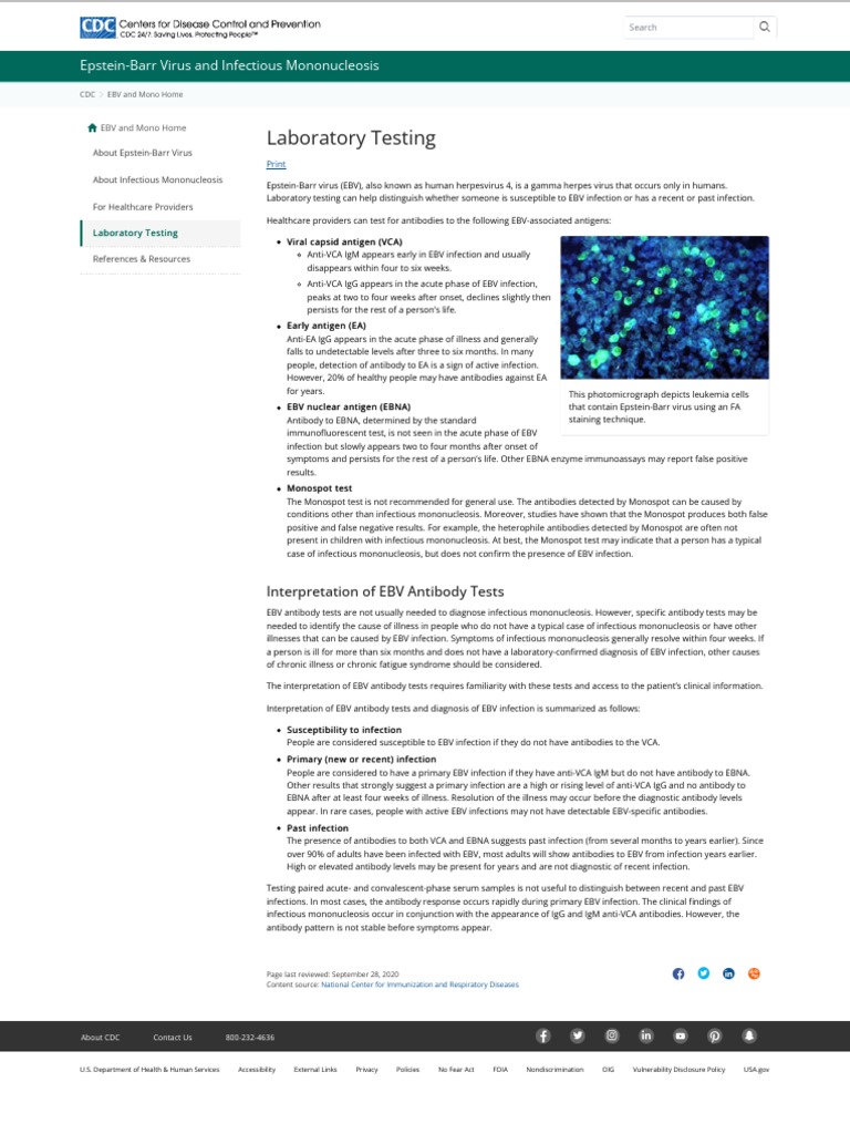 Epstein-Barr Virus Laboratory Testing - CDC | PDF | Infection | Serology