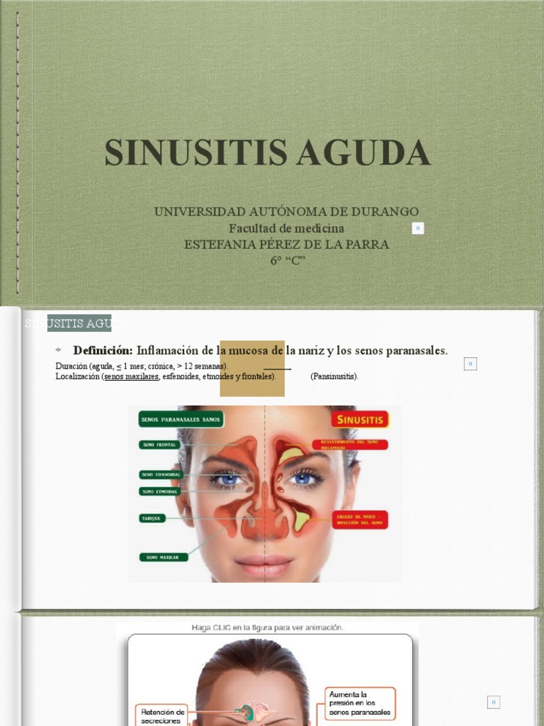 SINUSITIS AGUDA .pptx | PDF | Especialidades Medicas | Medicina CLINICA