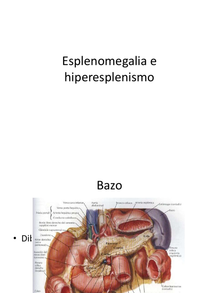 Esplenomegalia e Hiperesplenismo en Niños | PDF | Leucemia | Infección