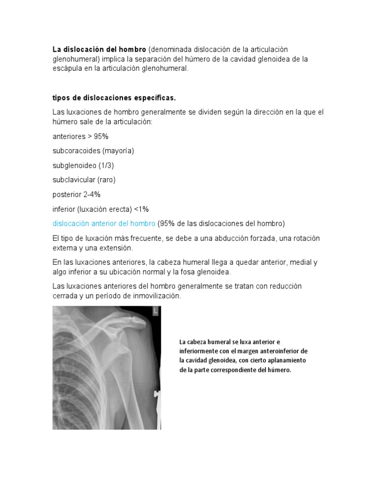 Dislocacion de Hombro | PDF | Hombro | Anatomía humana