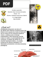 Anatomía y Clasificación del Colédoco | PDF | Vesícula biliar ...
