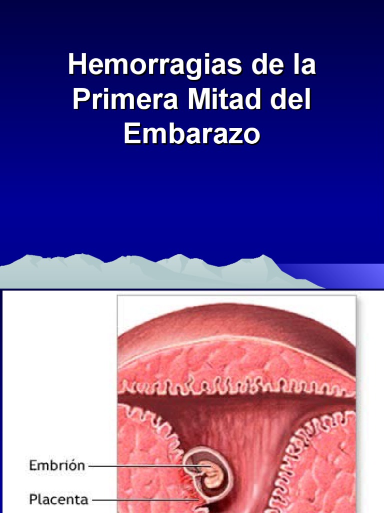Hemorragias de La Primera Mitad Del Embarazo | PDF | El embarazo ...