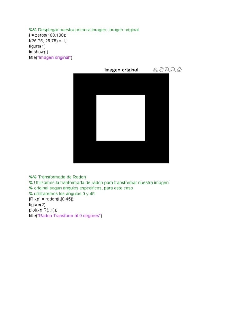 Radon Transform Matlab | PDF