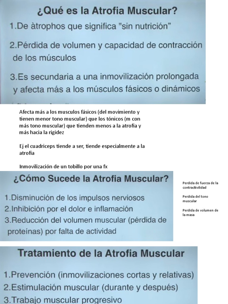 Atrofia Muscular | PDF