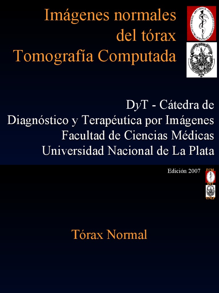 Imagenes TAC Torax Normal | PDF | Aorta | Arteria carótida común