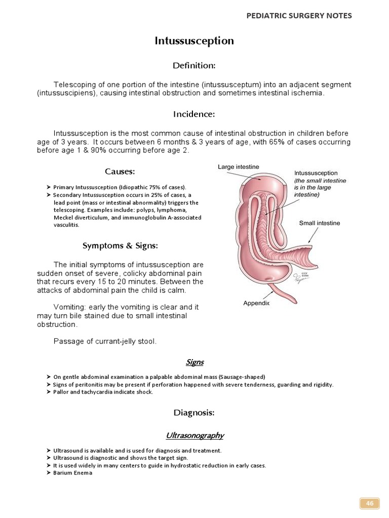 Intussusception | PDF | Human Diseases And Disorders | Medical Specialties