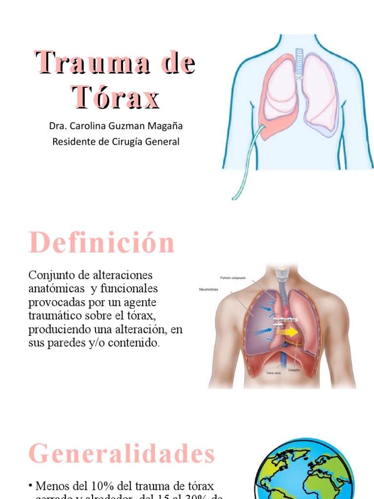 Manejo del Trauma Torácico | PDF