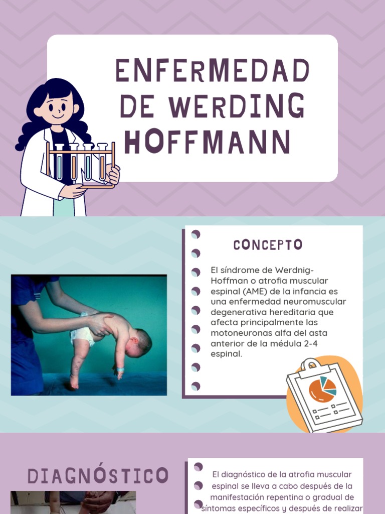 Enfermedad de Werding Hoffman | PDF | Síntoma | Diagnostico medico